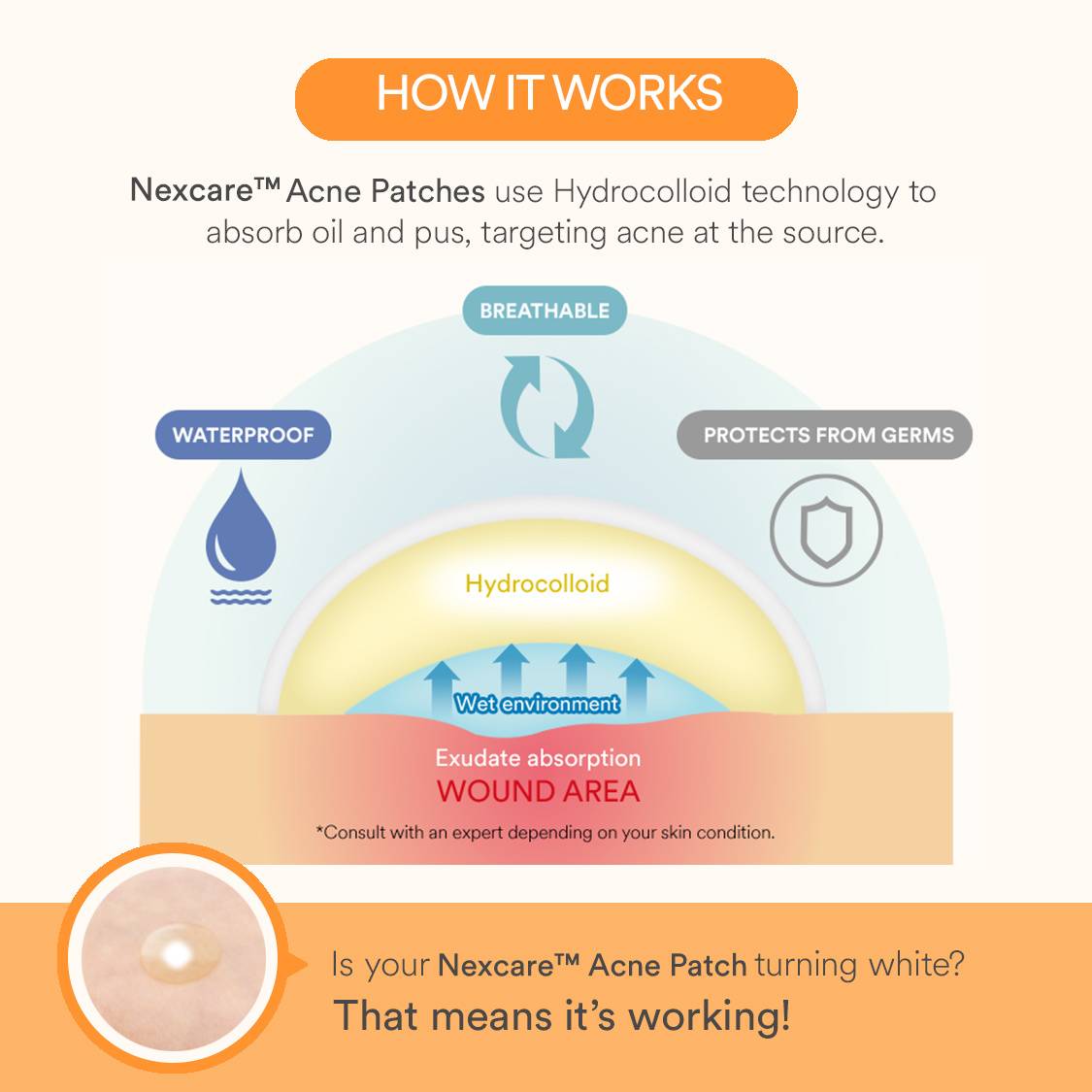 NEXCARE ACNE PATCH 7S